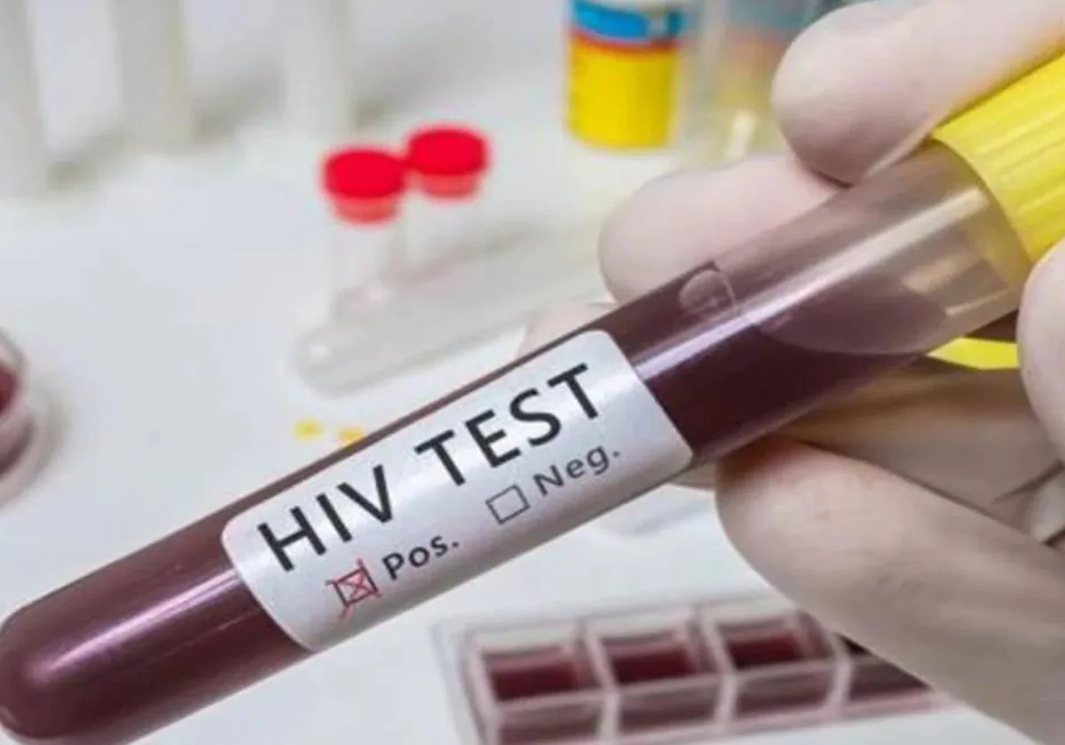 Berlín confirma un nuevo caso de curación en un paciente de SIDA